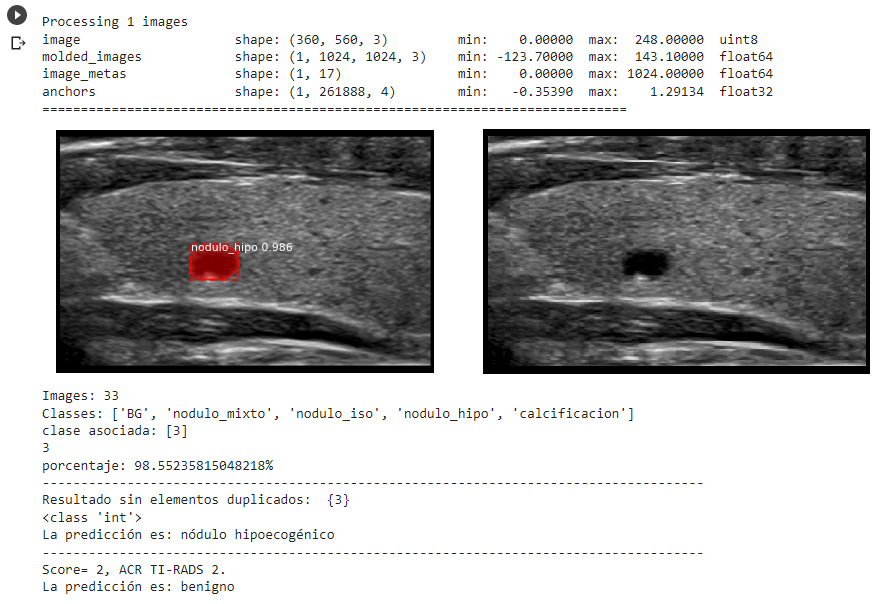 GitHub - GuCuChiara/Thyroid_Mask_RCNN: Mask R-CNN for Thyroid nodules ...