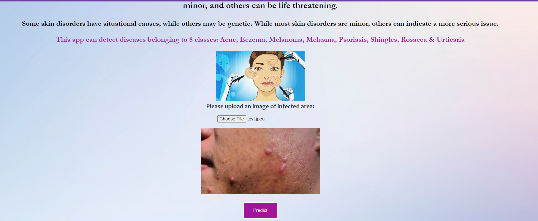 GitHub - Mansi67/Skin_Disease_Classification_CNN