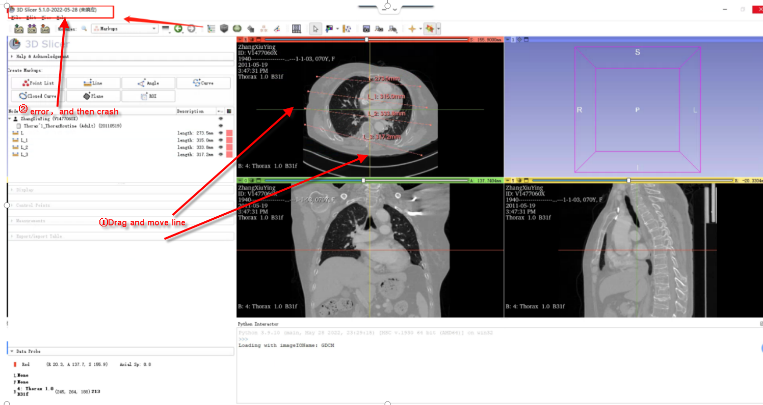 Crash In Slice View Showing Markups And Interactive Slice Intersections · Issue 6400 · Slicer