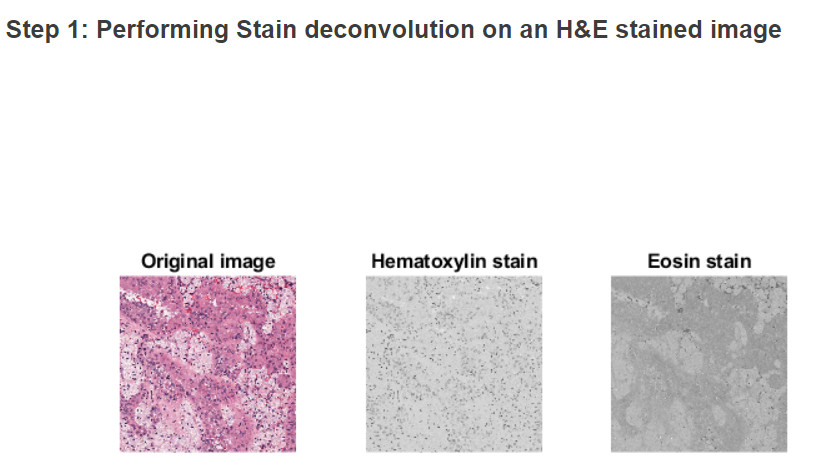 GitHub - selokarabhishek/Stain-Density-Estimation: Stain Deconvolution ...