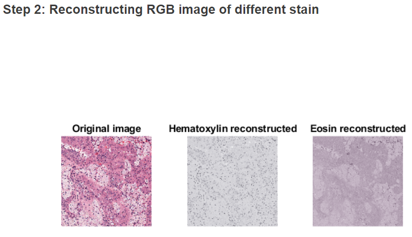 GitHub - selokarabhishek/Stain-Density-Estimation: Stain Deconvolution ...