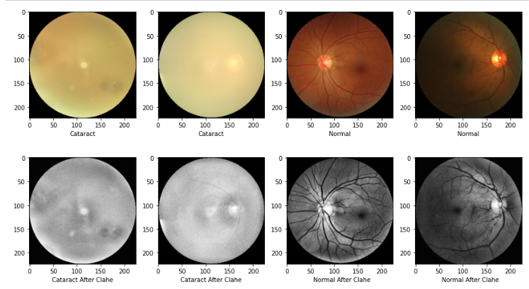 GitHub - selokarabhishek/Ocular-Disease-Recognition