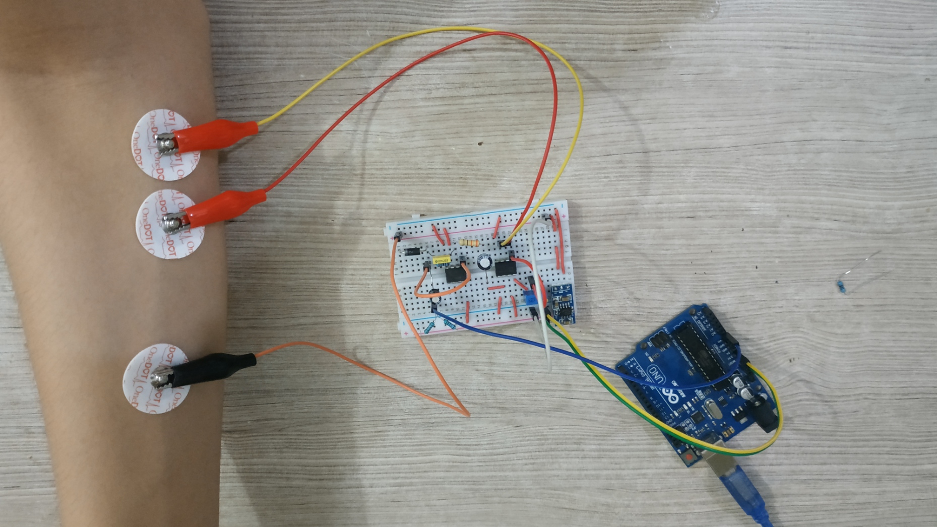 Github Ronaaron61 Emg Ecg Arduino Make Emg And Ecg Sensor To Read