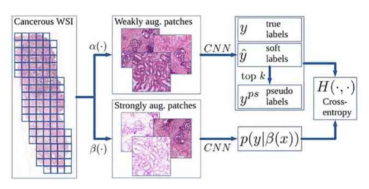 GitHub - bibiana1202/public-4th-place-DACON-AI-competition-for-predicting-lymphadenopathy-of ...