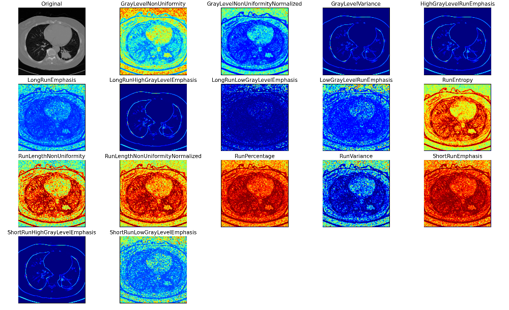 GitHub - sakaLabo/PyradiomicsVisualizer