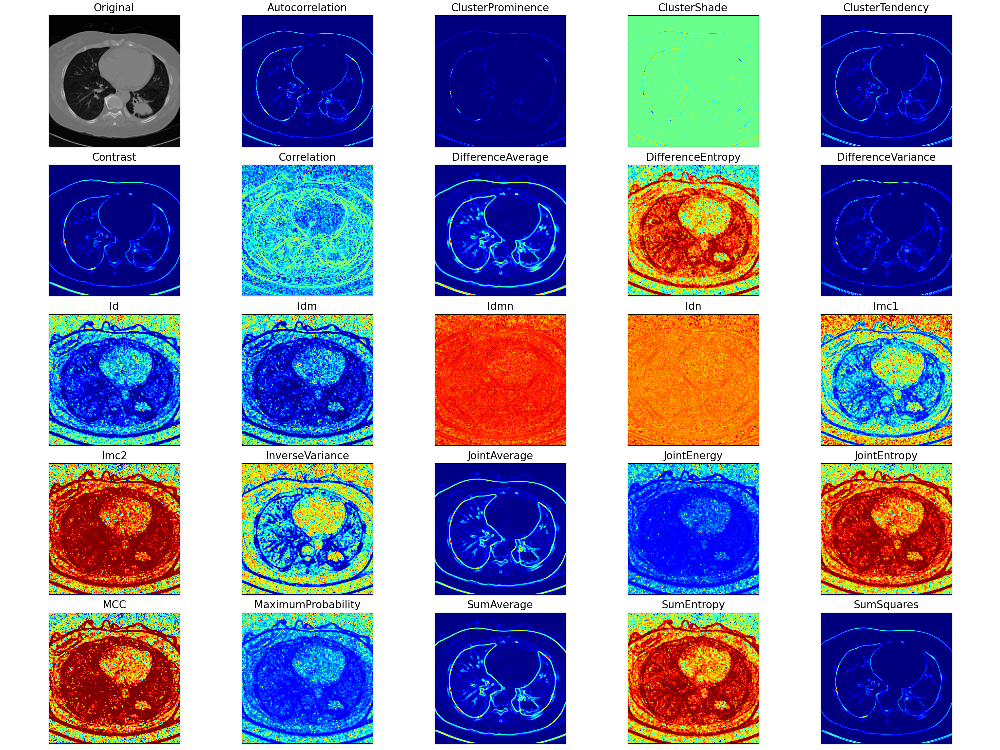 GitHub - sakaLabo/PyradiomicsVisualizer