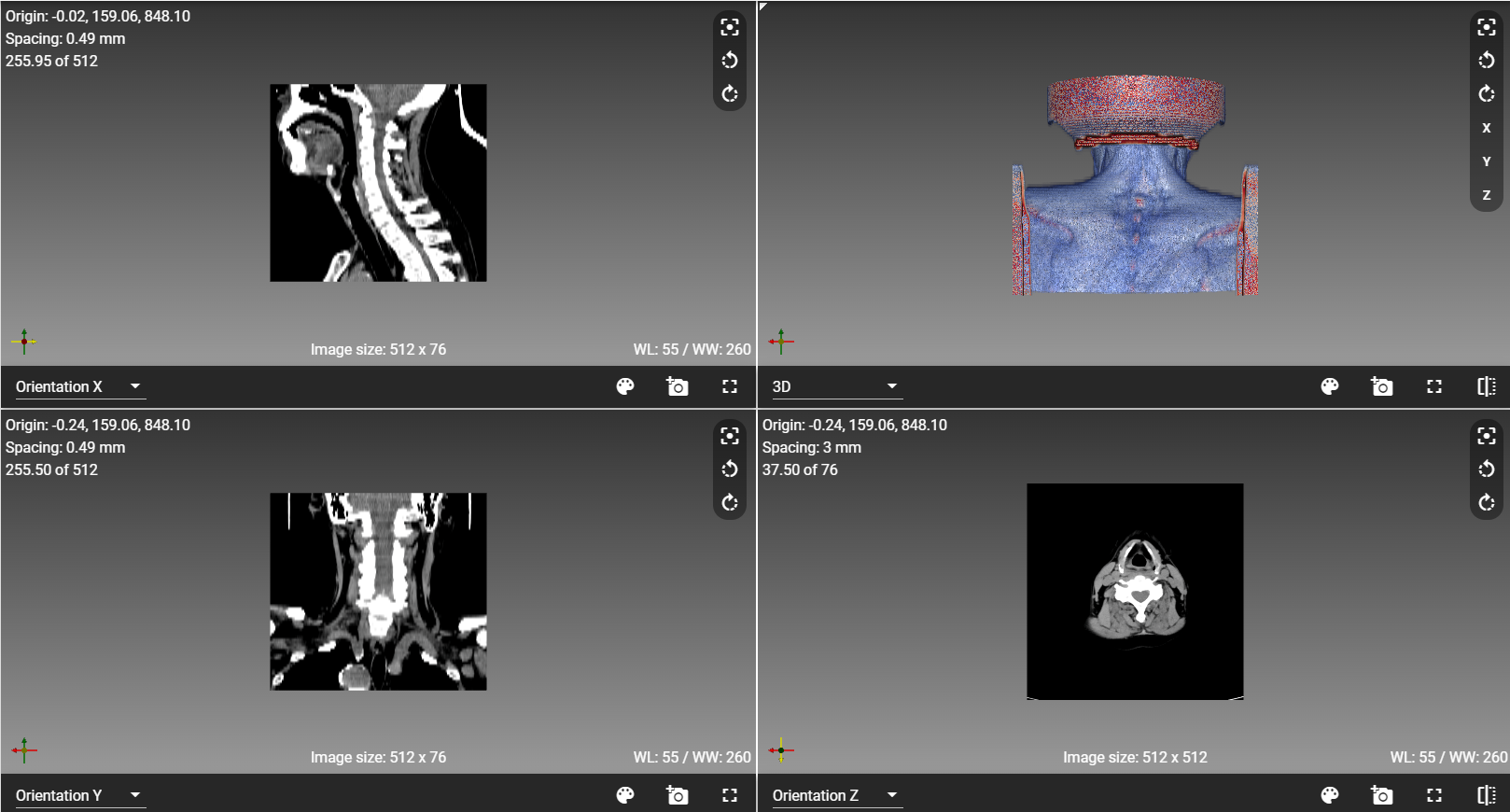 higher customization possibilities for the interface layout · Issue #702 · niivue/niivue · GitHub