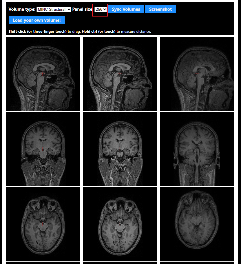 higher customization possibilities for the interface layout · Issue #702 · niivue/niivue · GitHub