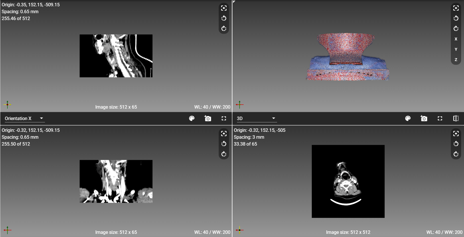 higher customization possibilities for the interface layout · Issue #702 · niivue/niivue · GitHub