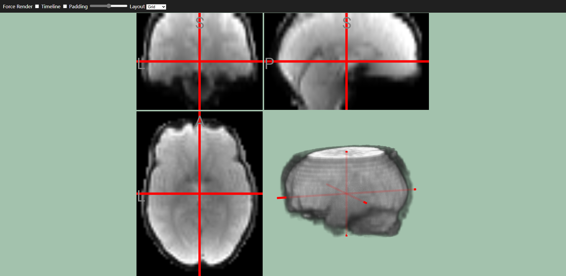 higher customization possibilities for the interface layout · Issue #702 · niivue/niivue · GitHub