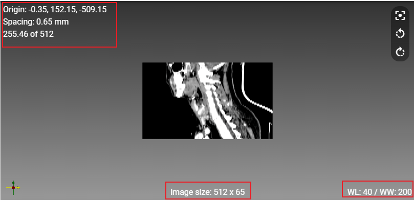 higher customization possibilities for the interface layout · Issue #702 · niivue/niivue · GitHub