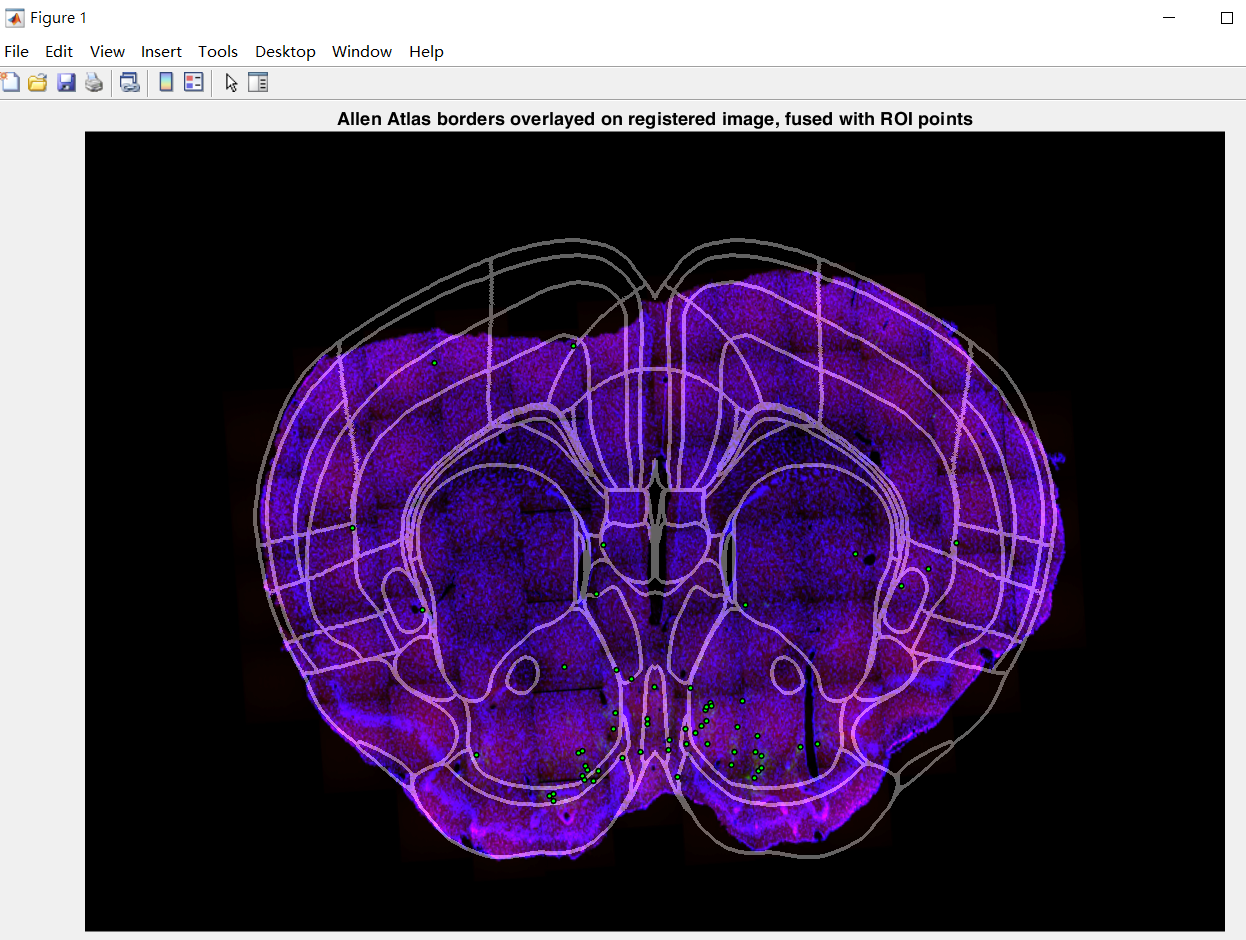 Step 4: Analyze Section with Allen Atlas · Issue #8 · wildrootlab ...