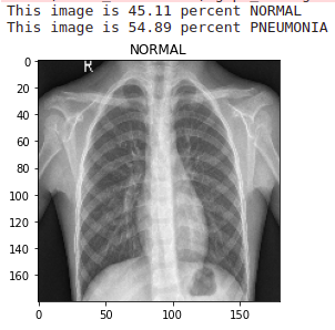 GitHub - sahilfaizal01/Pneumonia-Detection-Using-CNNs: This is a binary classification project ...