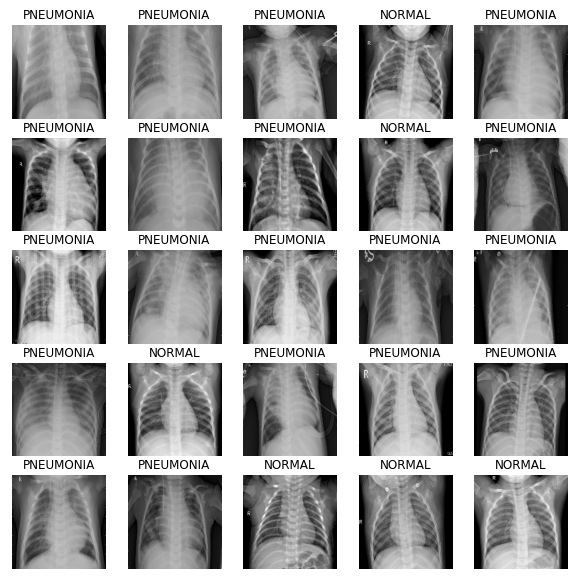 GitHub - sahilfaizal01/Pneumonia-Detection-Using-CNNs: This is a binary classification project ...