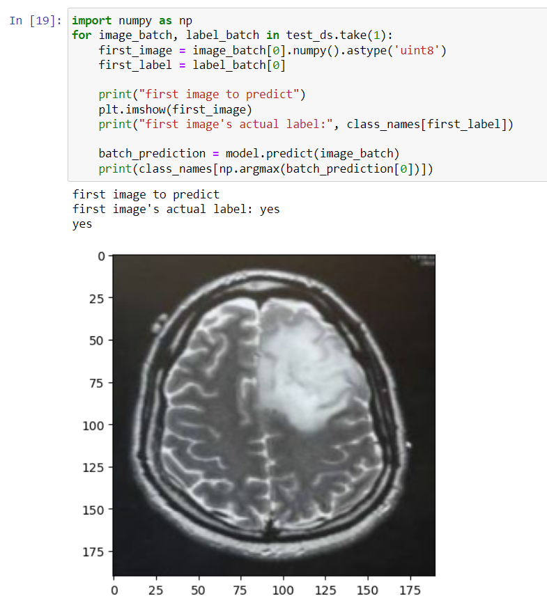 GitHub - Sidhu2295/Brain_Scans_IC_Project: An image classification ...