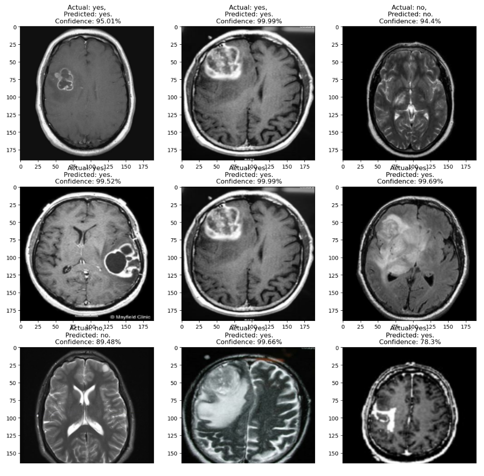 GitHub - Sidhu2295/Brain_Scans_IC_Project: An image classification ...