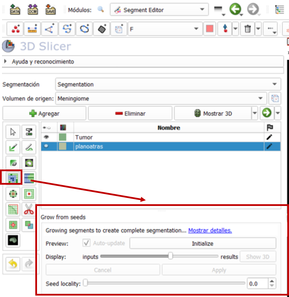 Segment Editor module not fully translated into Spanish version 5.4.0 · Issue #45 · Slicer ...
