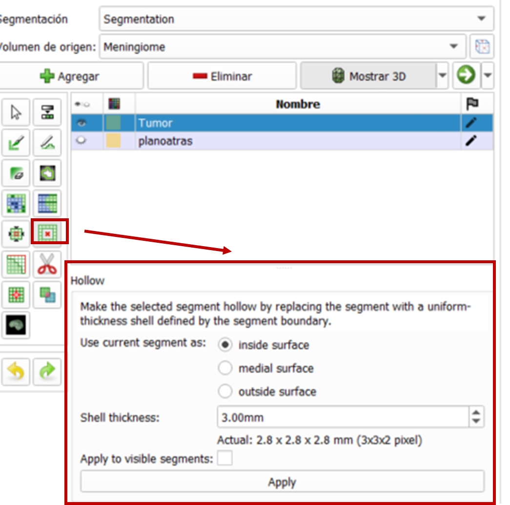 Segment Editor module not fully translated into Spanish version 5.4.0 · Issue #45 · Slicer ...