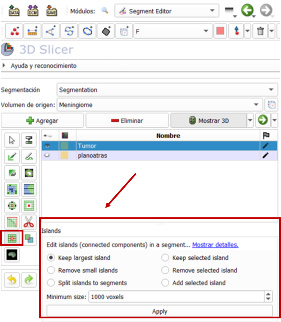 Segment Editor module not fully translated into Spanish version 5.4.0 · Issue #45 · Slicer ...