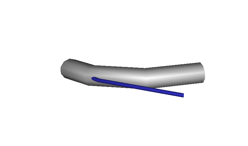 BeamAdapter Multiple Guidewire in Single Catheter · sofa-framework sofa · Discussion #3621 · GitHub