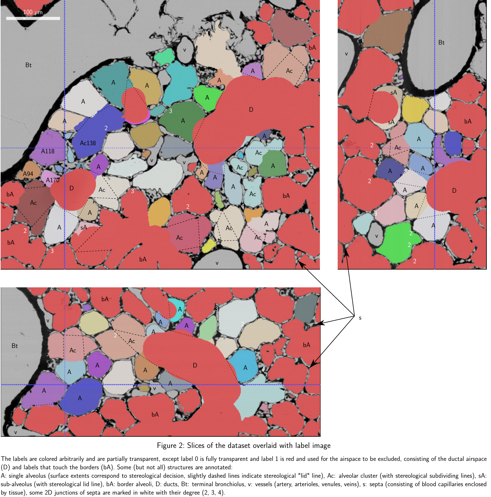 Partitioning 3D surface meshes using watershed segmentation · Issue #4 ...