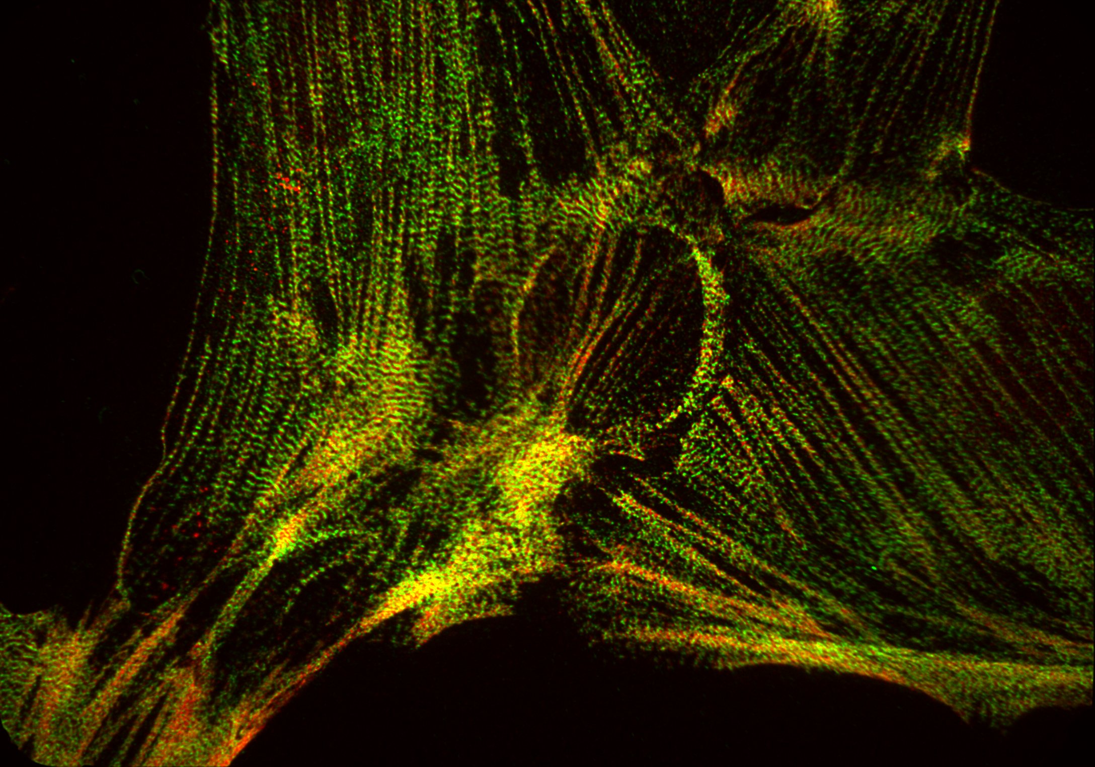 GitHub - eexuesong/RL_decon_spatial_domain