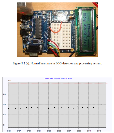 GitHub - deshuttam/Wireless-ECG-Monitoring-System-: Wireless ECG ...