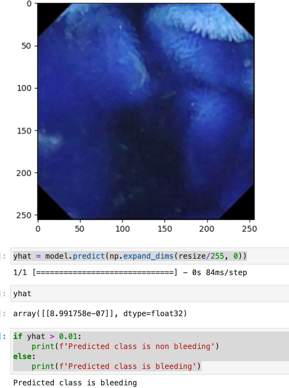 GitHub - Ayu5-h/WCEBleedGen-Challenge: Detecting if the endoscopy frames are bleeding or non ...