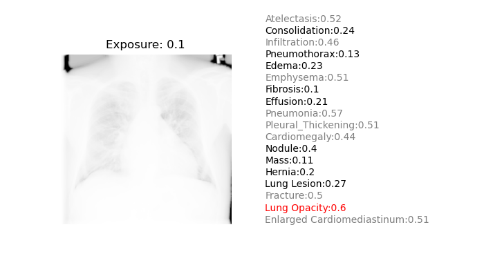Why I'm getting different results for the same image? · Issue #128 · mlmed/torchxrayvision · GitHub