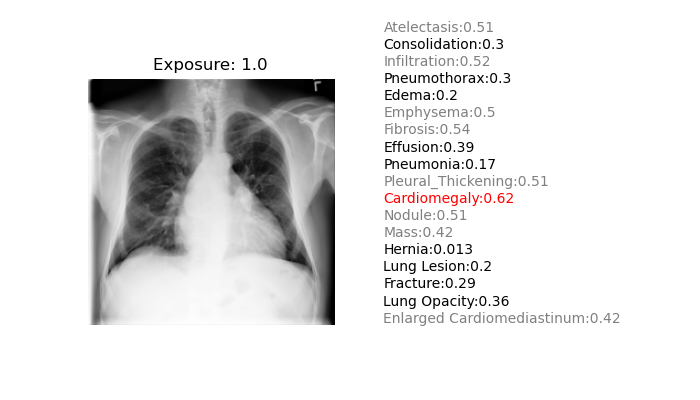 Why I'm getting different results for the same image? · Issue #128 · mlmed/torchxrayvision · GitHub