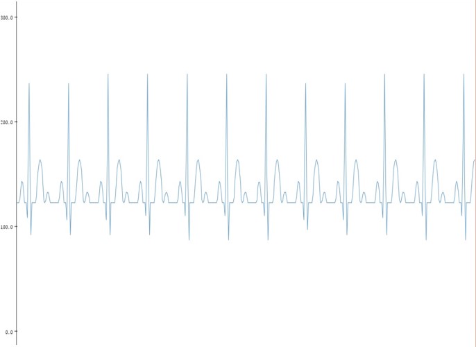 GitHub - darkcrow-dev/Simulador-ECG: Programa en la cual se simula el ritmo cardiaco en ...