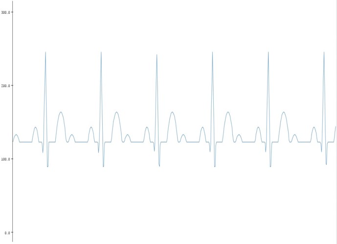 GitHub - darkcrow-dev/Simulador-ECG: Programa en la cual se simula el ritmo cardiaco en ...