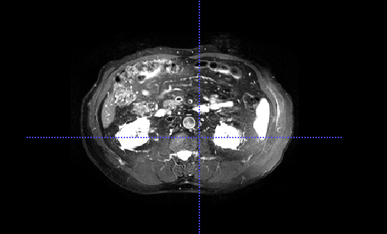 Issues with custom dataset. · Issue #468 · voxelmorph/voxelmorph · GitHub