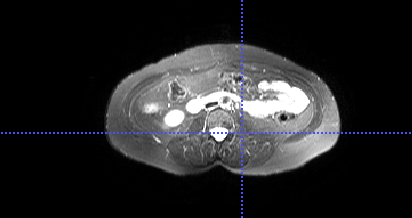 Issues with custom dataset. · Issue #468 · voxelmorph/voxelmorph · GitHub