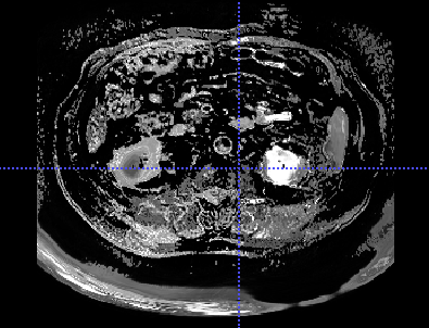 Issues with custom dataset. · Issue #468 · voxelmorph/voxelmorph · GitHub