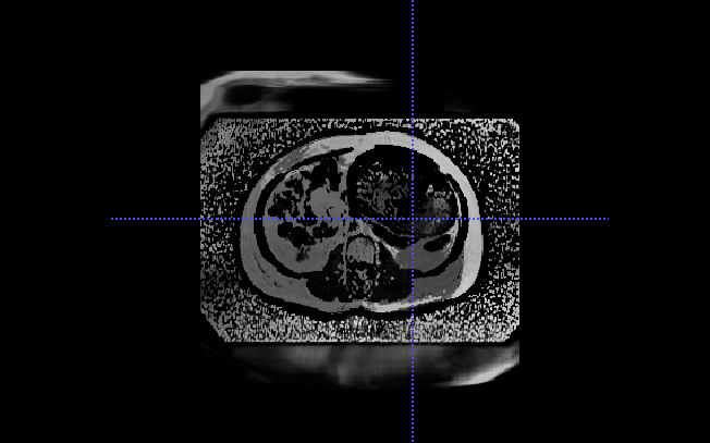 Issues with custom dataset. · Issue #468 · voxelmorph/voxelmorph · GitHub