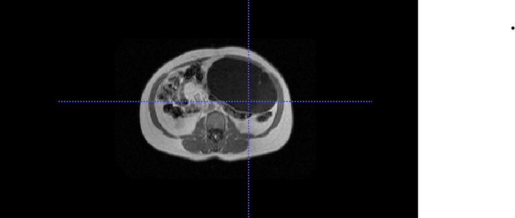 Issues with custom dataset. · Issue #468 · voxelmorph/voxelmorph · GitHub