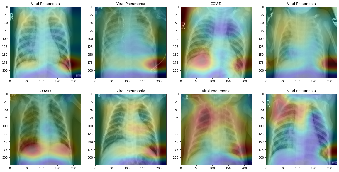 GitHub - kaledhoshme123/X-ray-Covid-19---Pneumonia-Heat-map: Obtaining a Heat Map of the areas ...