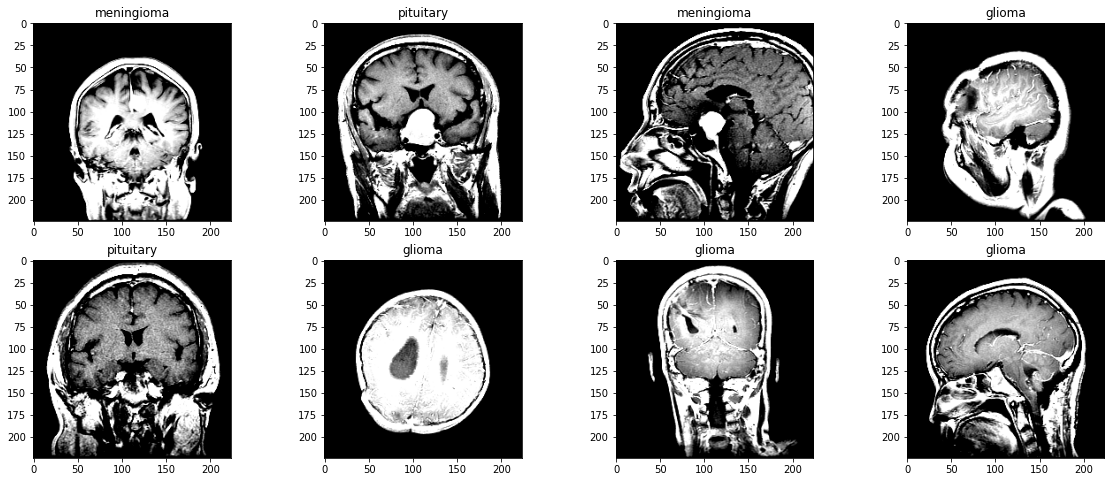 GitHub - kaledhoshme123/Convolutional-eXtreme-Gradient-Boosting-Brain-Tumor: Convolutional ...