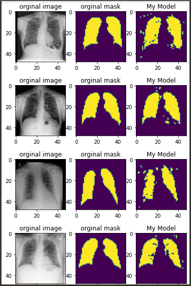 GitHub - kaledhoshme123/Semantic-Segmentation-of-the-lungs-from-X-ray ...
