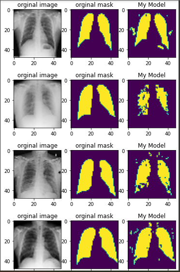 GitHub - kaledhoshme123/Semantic-Segmentation-of-the-lungs-from-X-ray ...