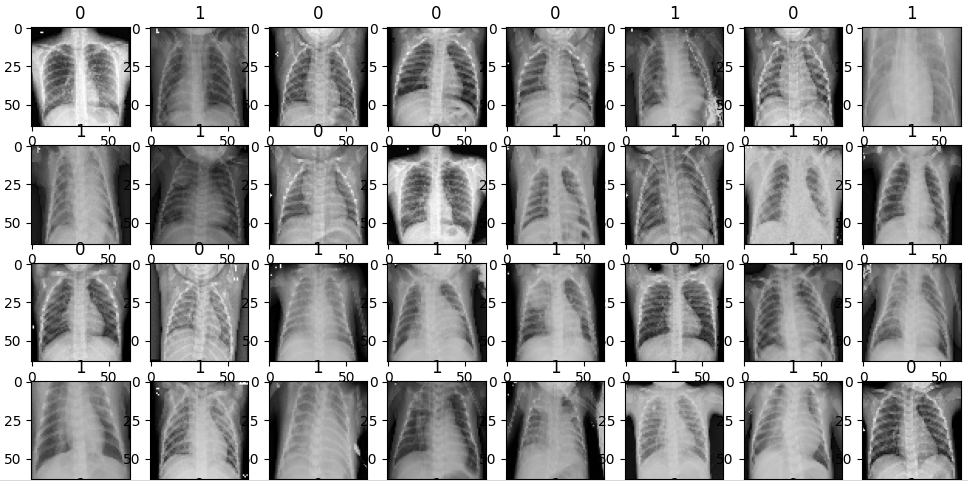 GitHub - kaledhoshme123/Using-GAN-to-Generate-Chest-X-Ray-Images: The following study presents a ...