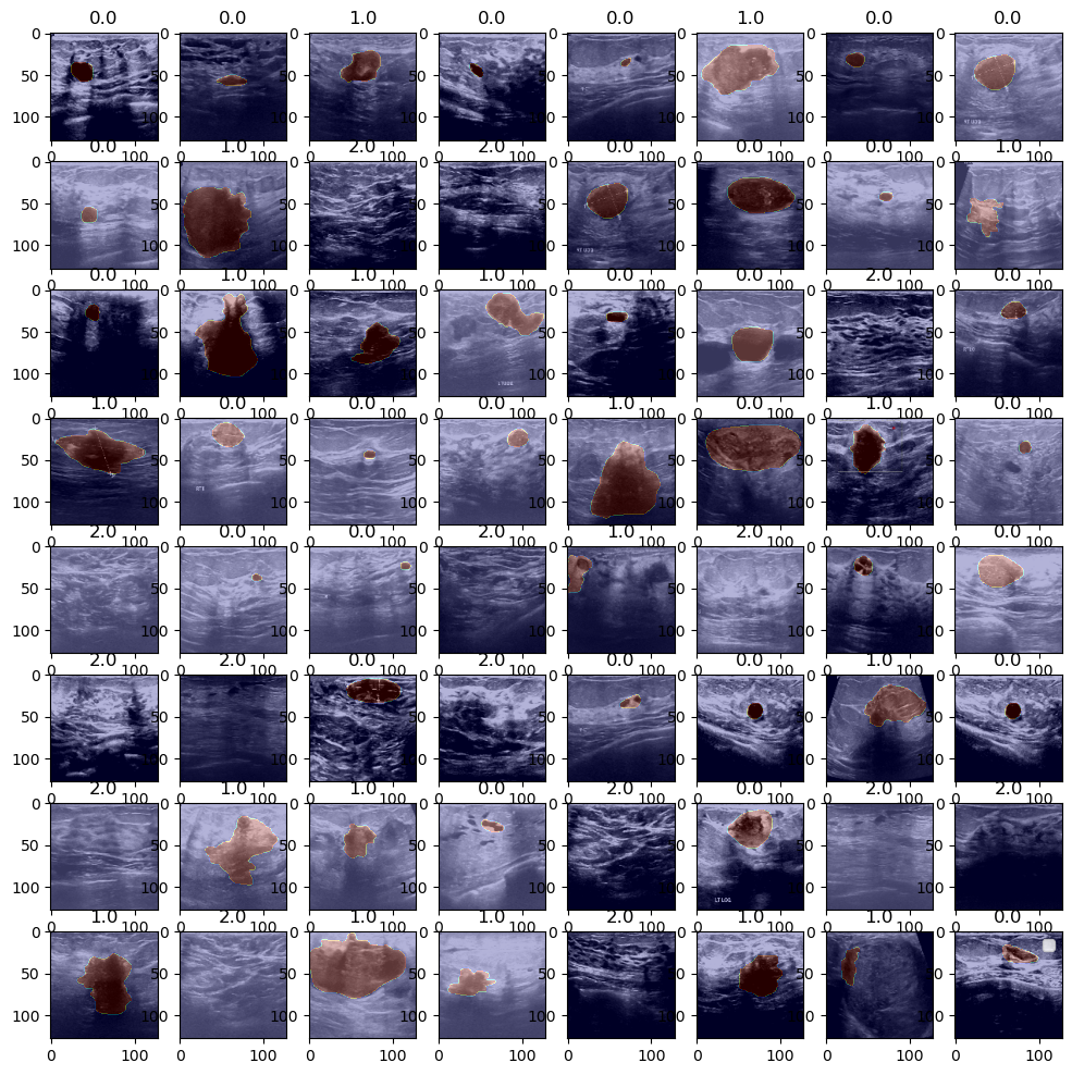 GitHub - kaledhoshme123/Breast-cancer-segmentation-malignant-benign ...