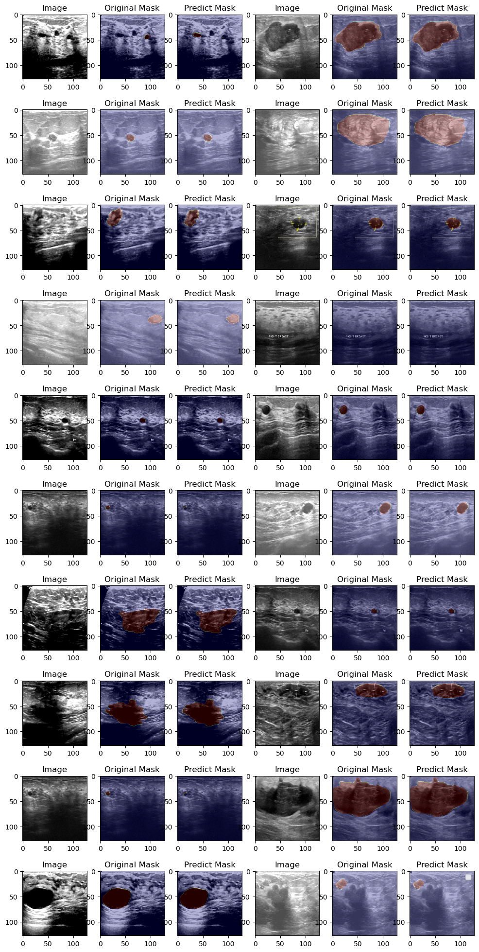GitHub - kaledhoshme123/Breast-cancer-segmentation-malignant-benign ...