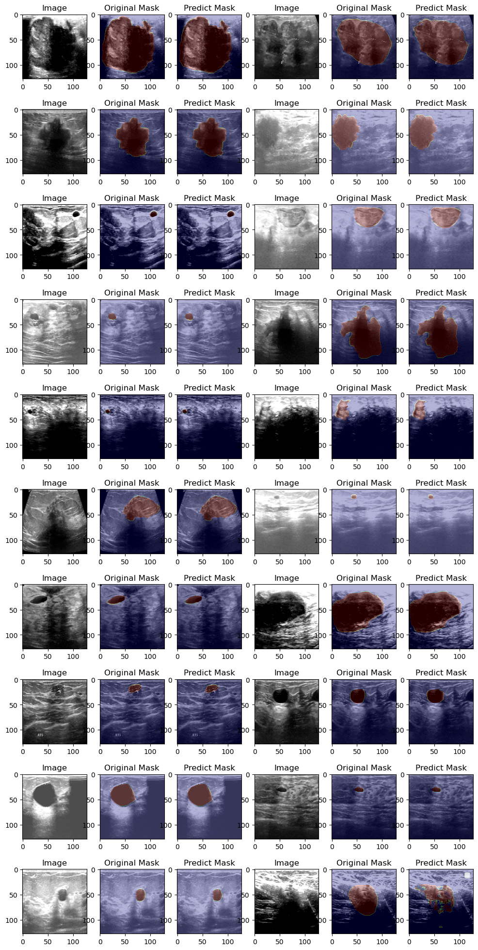 GitHub - kaledhoshme123/Breast-cancer-segmentation-malignant-benign ...