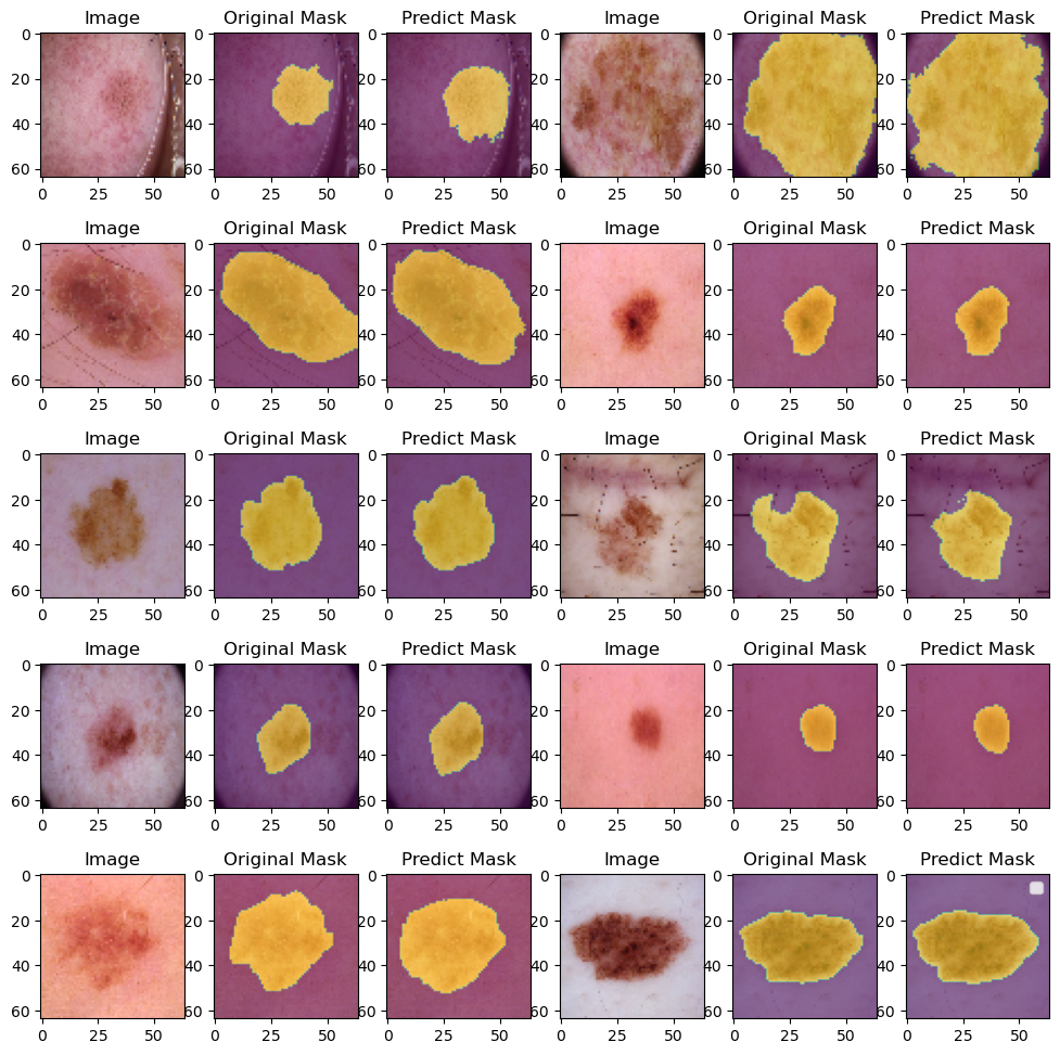 GitHub - kaledhoshme123/Determine-the-location-of-the-skin-lesion ...
