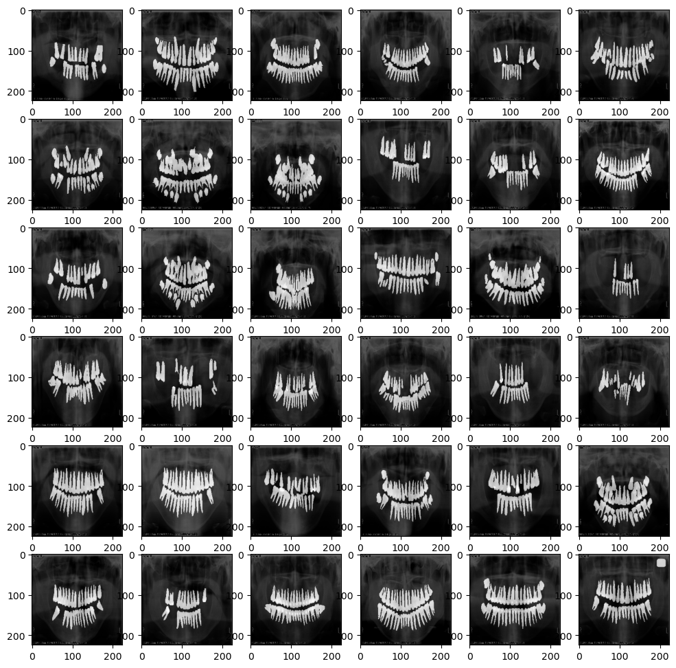 GitHub - kaledhoshme123/Adult-tooth-segmentation-U-net-based-GAN-: Dental segmentation for ...