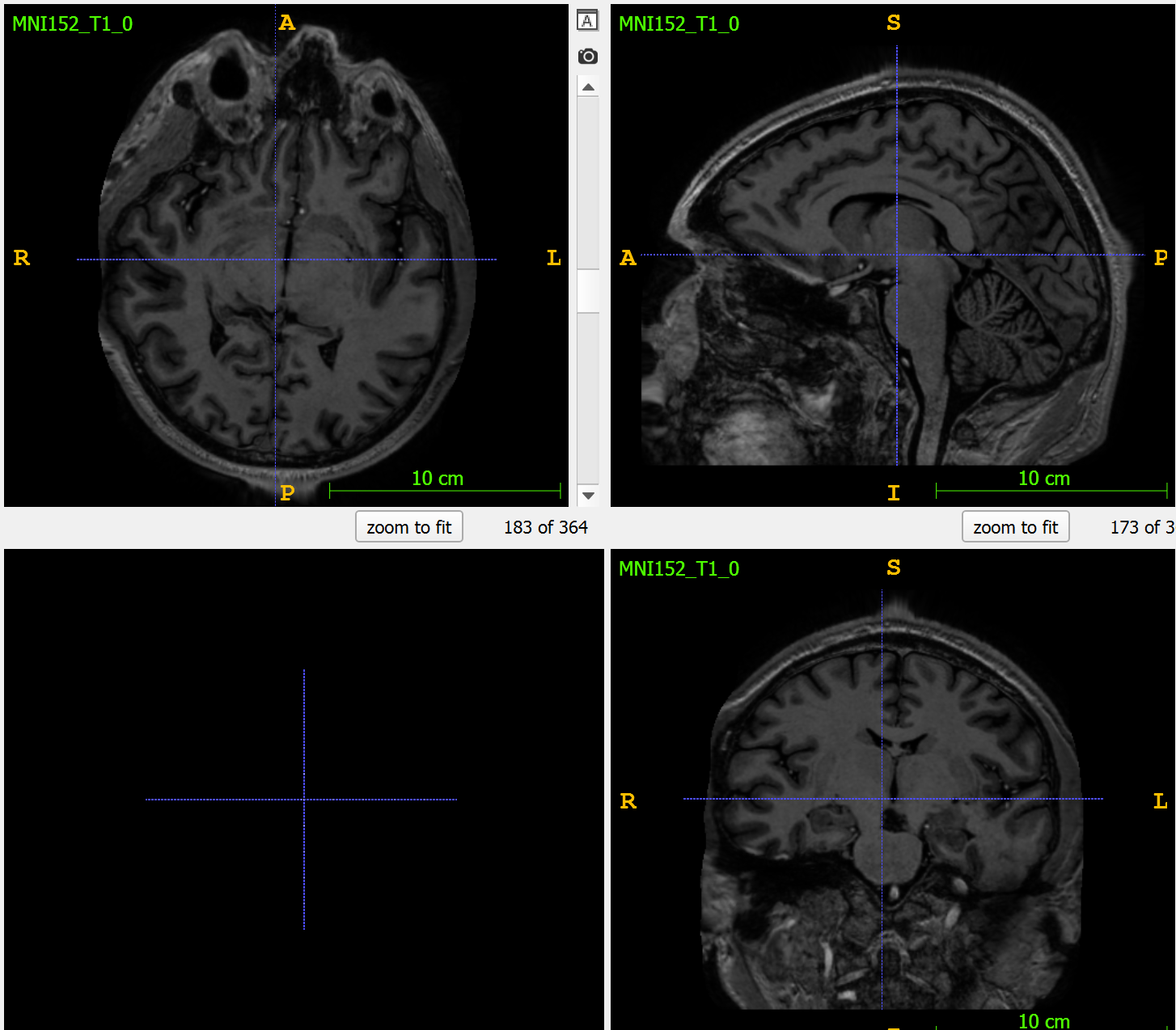 antsRegistrationSyN and antsRegistrationSyNQuick · Issue #1160 · ANTsX/ANTs · GitHub