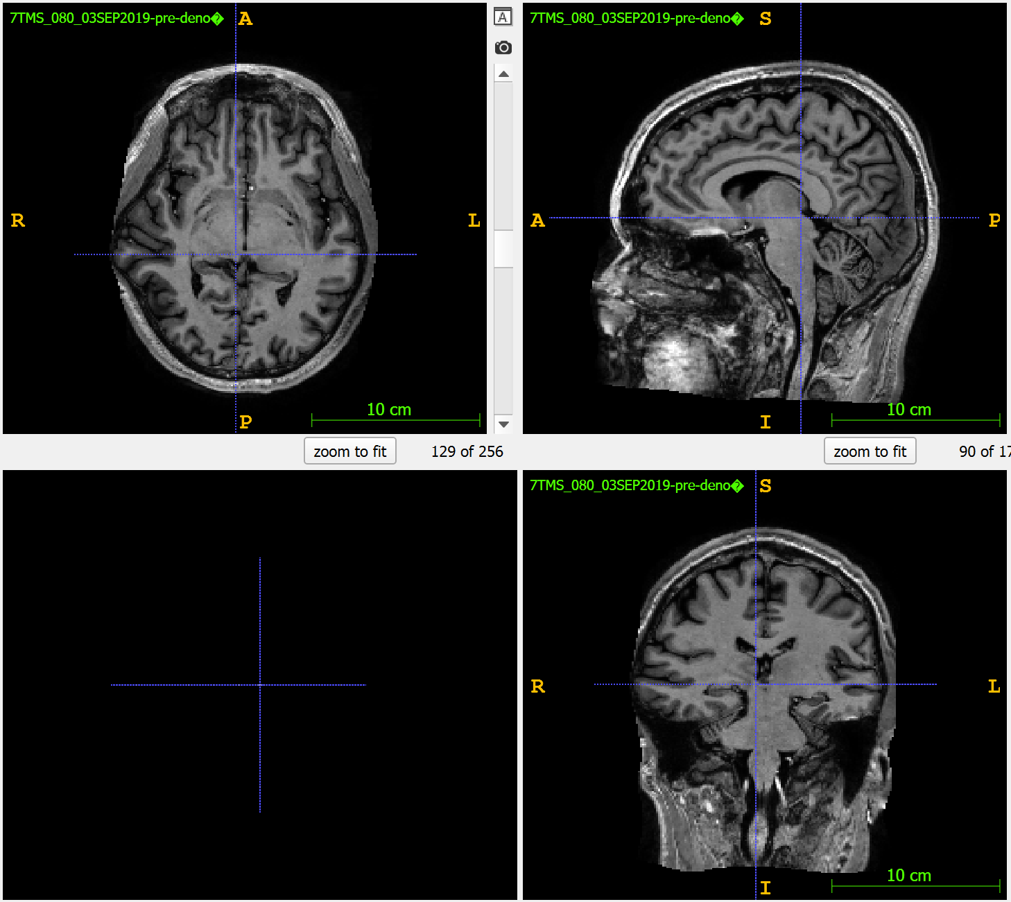 antsRegistrationSyN and antsRegistrationSyNQuick · Issue #1160 · ANTsX/ANTs · GitHub