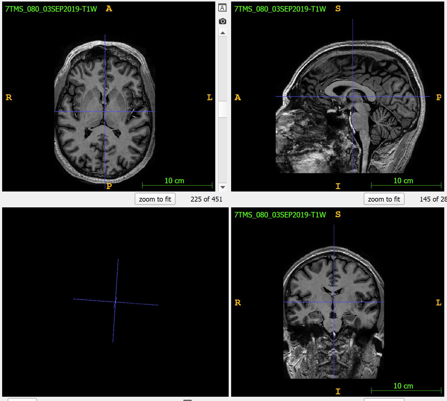 antsRegistrationSyN and antsRegistrationSyNQuick · Issue #1160 · ANTsX/ANTs · GitHub